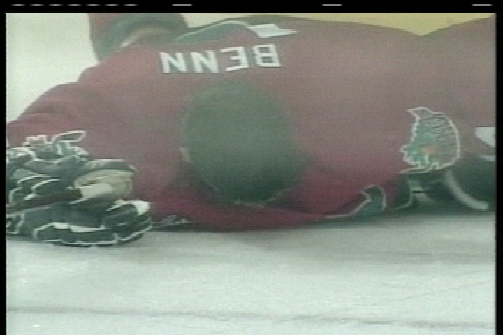 Concussions becoming epidemic in hockey | Globalnews.ca