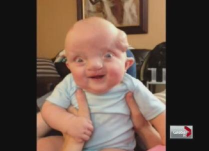 Baby Eli defies terrible odds | Globalnews.ca
