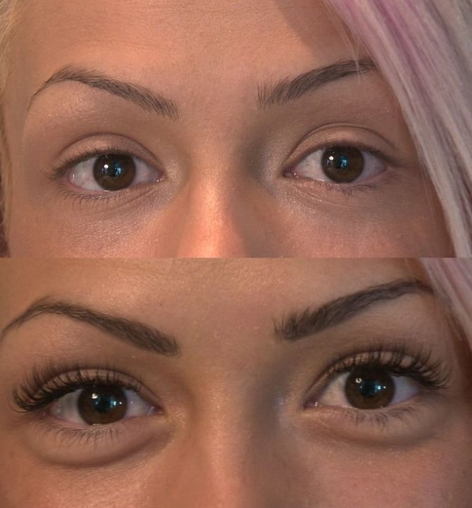 Eyelash extensions: what you should know - Edmonton | Globalnews.ca