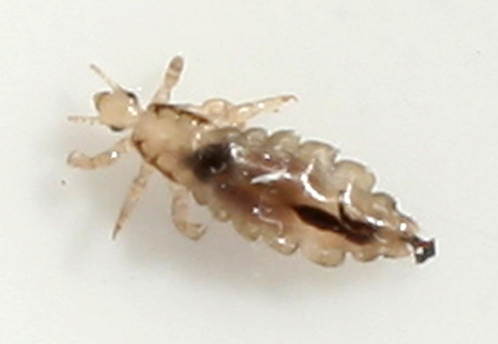 Winnipeg mom launches lice fight - Winnipeg | Globalnews.ca