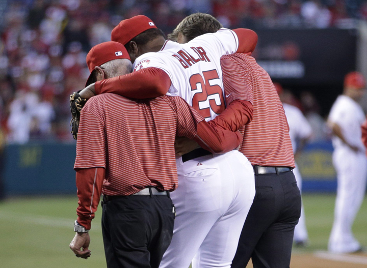 Angels coach Don Baylor has surgery on broken leg after opening-day ...