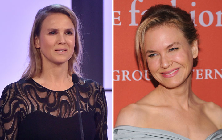 Renée Zellweger ‘thrilled’ with dramatic new look | Globalnews.ca