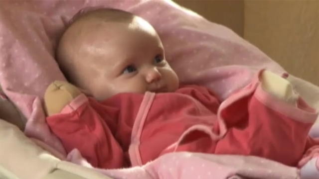WATCH: Rare skin condition makes baby Kiira untouchable - National ...