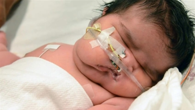 Baby weighing nearly 14 pounds born in Colorado - National | Globalnews.ca
