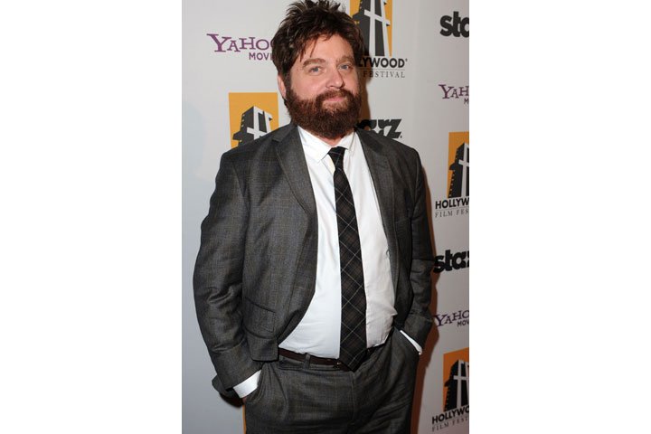 Zach Galifianakis shows off new look at SAG Awards | Globalnews.ca