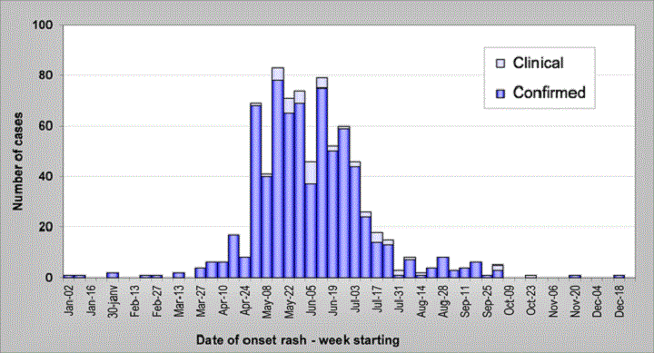 By the numbers: The last measles outbreak in Quebec - Montreal ...