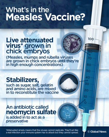 What’s in a measles vaccine? 4 things you need to know | Globalnews.ca