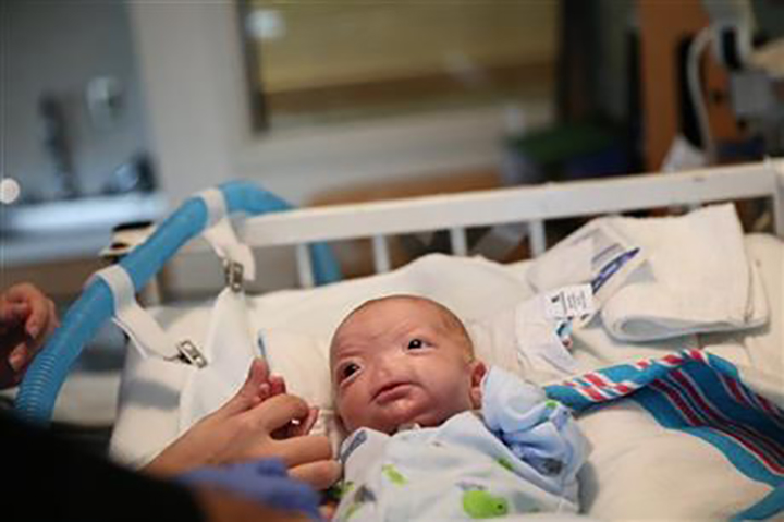 Mom says baby born without a nose ‘perfect the way he is’ - National ...
