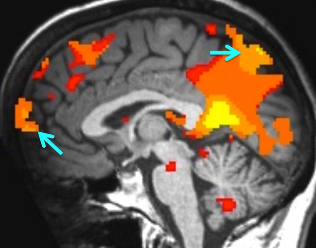 Living with SDAM means living without memories - National | Globalnews.ca