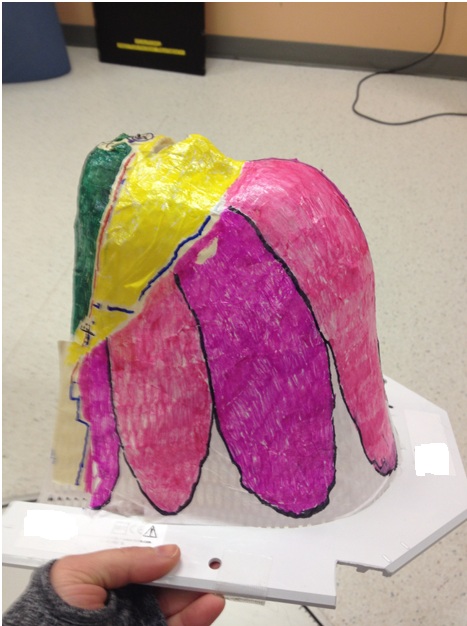 Painted masks help young patients fight brain tumours - Halifax ...