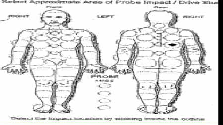 Taser Files: What we found in 594 pages of Taser incident reports ...