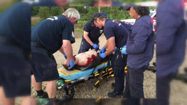 ‘I touched death that day’: Man survives lightning strike that killed ...