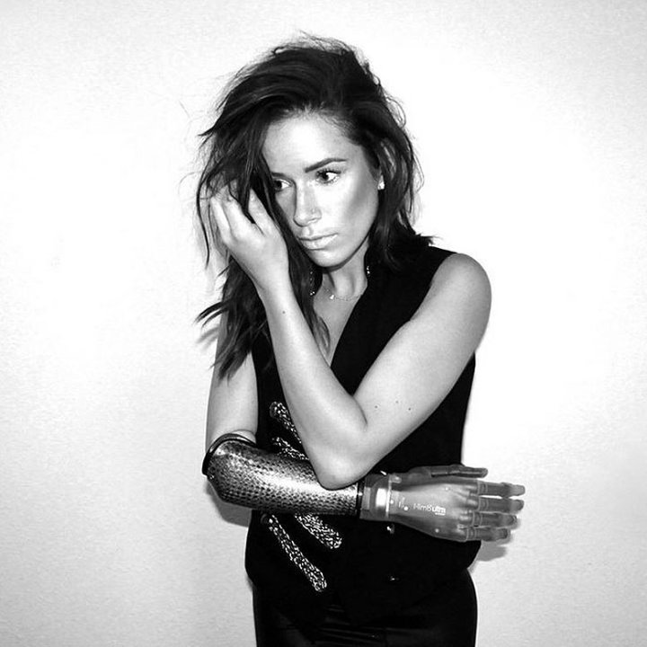 Meet the model with a bionic arm walking in New York Fashion Week ...