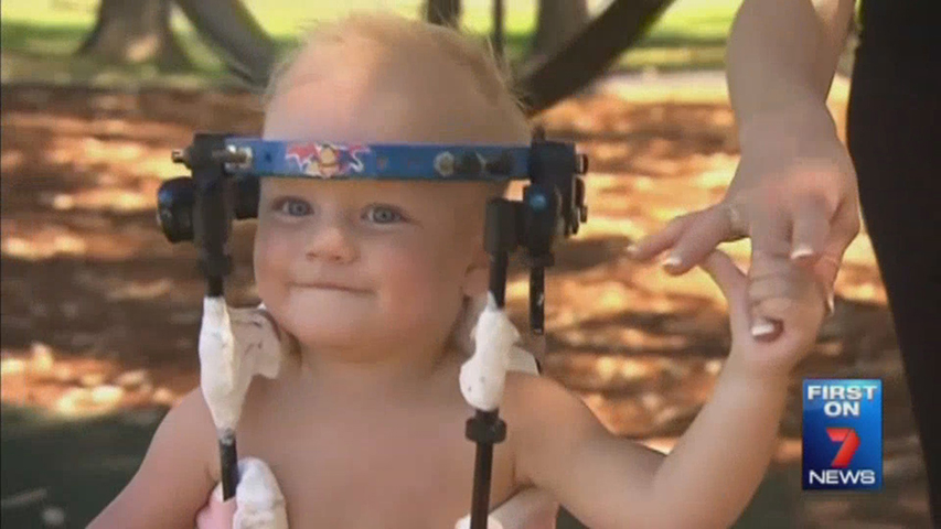 Australian baby’s head reattached to severed spinal cord in ‘miracle ...