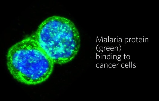 UBC researchers use malaria protein to help fight cancer - BC ...