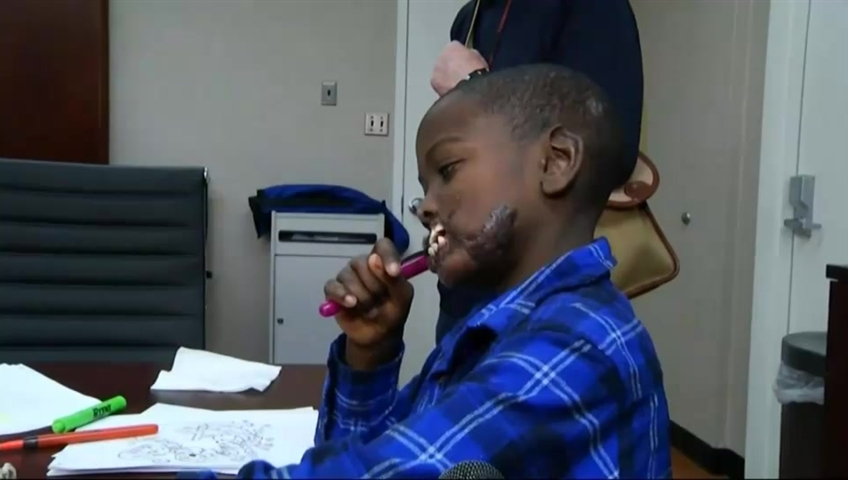 WATCH: Boy attacked by chimp to undergo rare facial surgery - National ...