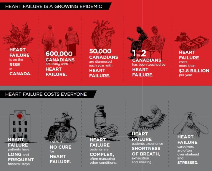 Heart failure rates rising in Canada: Heart and Stroke Foundation ...