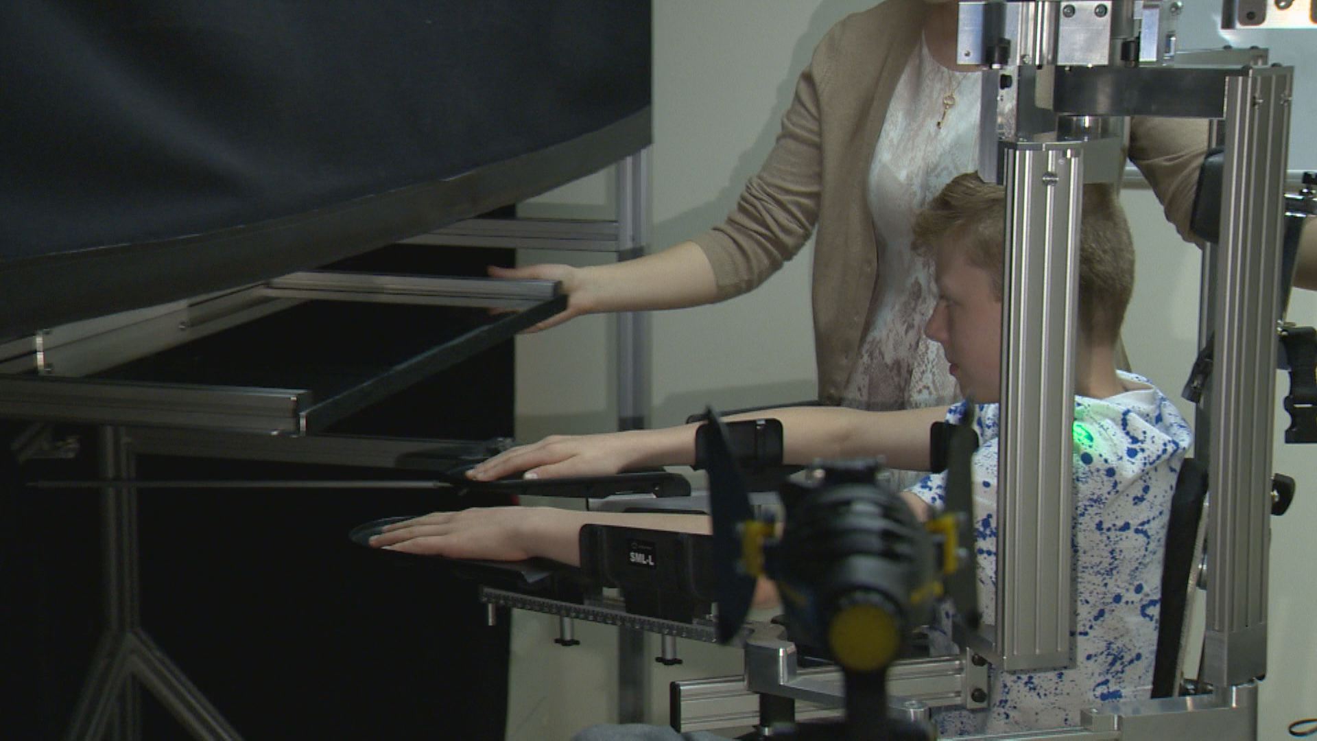 Robotic device helping young stroke survivors recover | Globalnews.ca