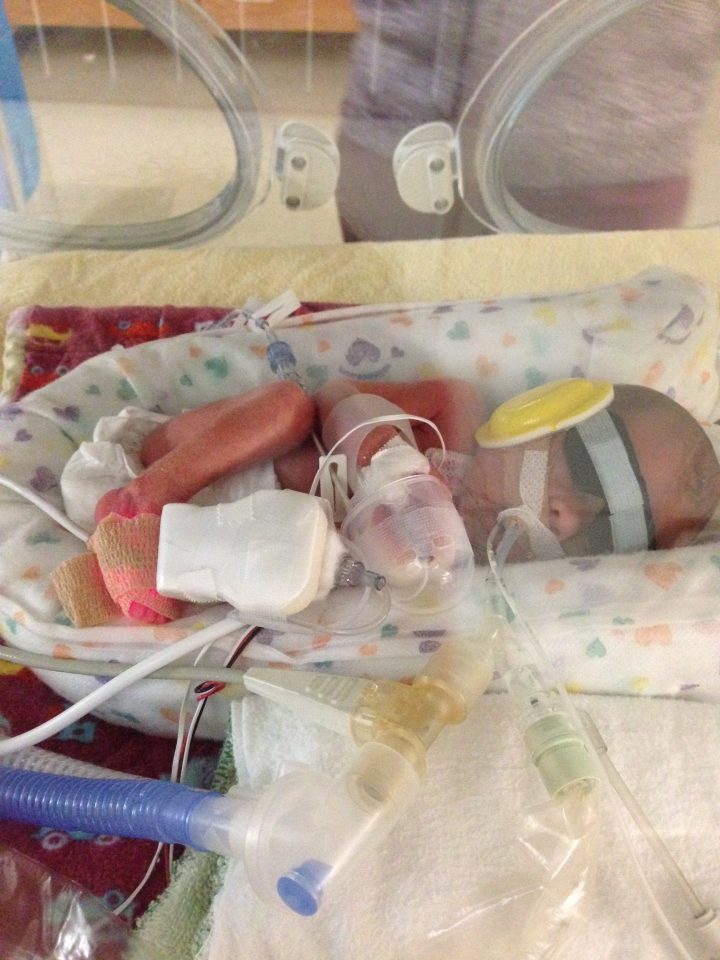 ‘It’s where the most miracles happen’: a story of hope in the NICU ...