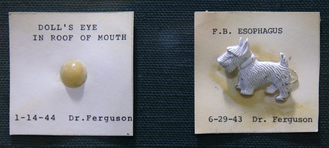 Yuck! The weird things kids swallow go on display - National ...