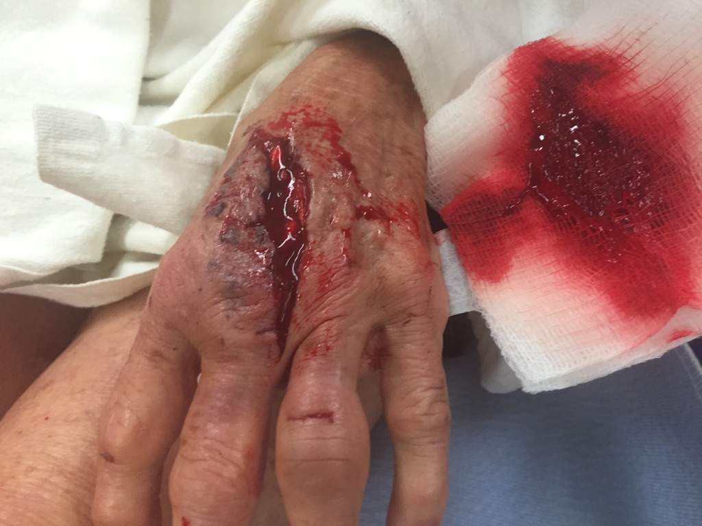 City of White Rock investigates ‘vicious’ dog attack - BC | Globalnews.ca