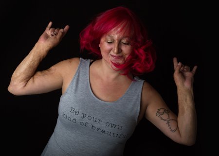 Alberta photography project highlights beauty in scars | Globalnews.ca