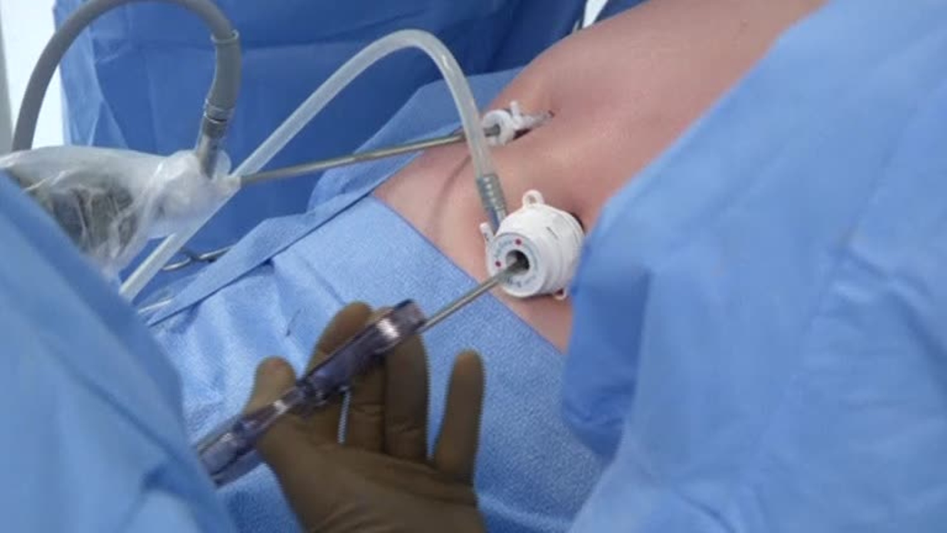 This new surgical technique uses a magnet instead of a scalpel ...