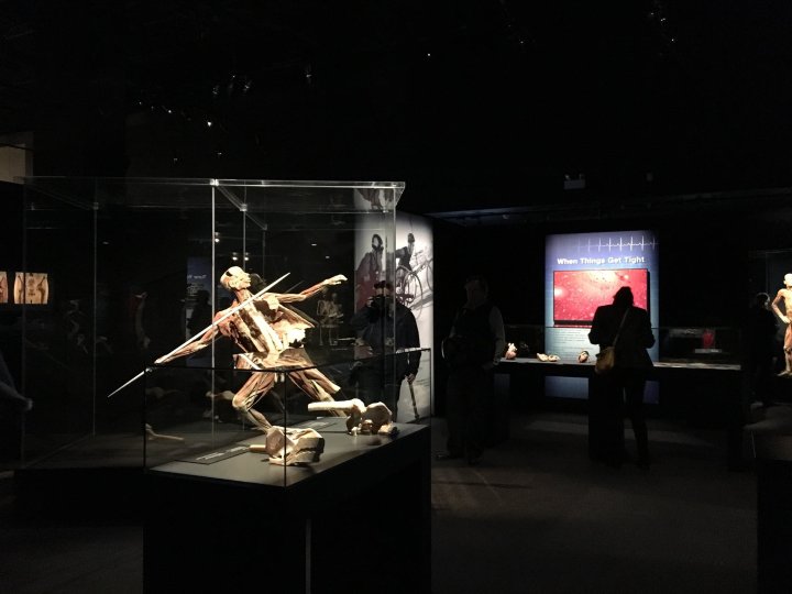 Body Worlds RX exhibit featuring preserved human bodies in Atlantic ...