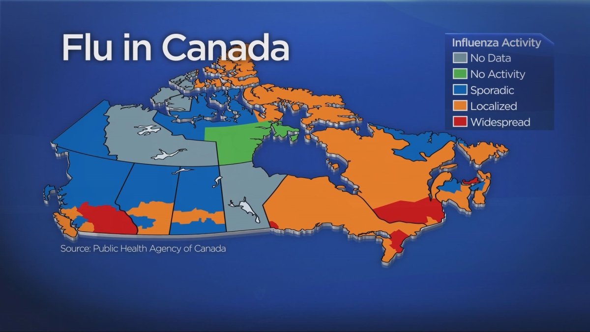 Montreal suffering through unusually bad flu season - Montreal ...