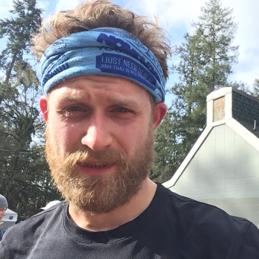 Victim of random attack in Victoria facing long recovery - BC ...