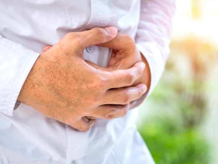 How to get rid of belly bloat - National | Globalnews.ca