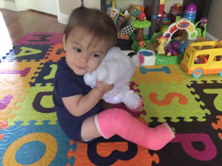 Frightening photo of toddler breaking her leg on slide is a warning for ...