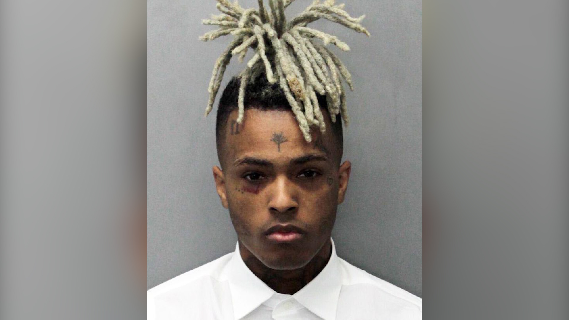 Rapper XXXTentacion dead at age 20 in Miami-area shooting - National ...