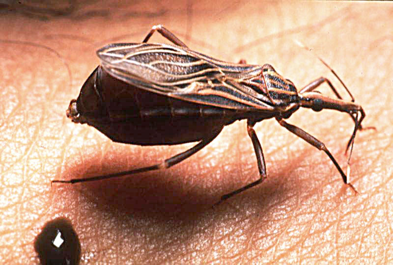 Chagas disease: Why U.S. doctors are warning about the ‘kissing bug ...