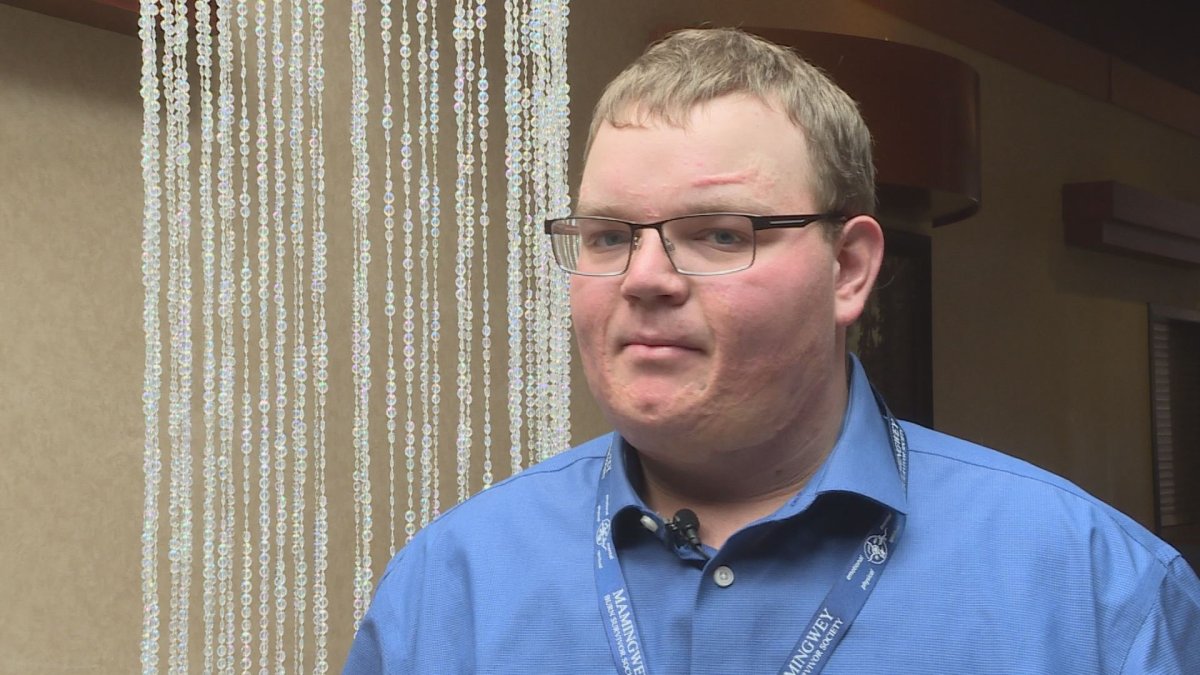 Manitoba burn survivors share struggles, hope at annual conference ...