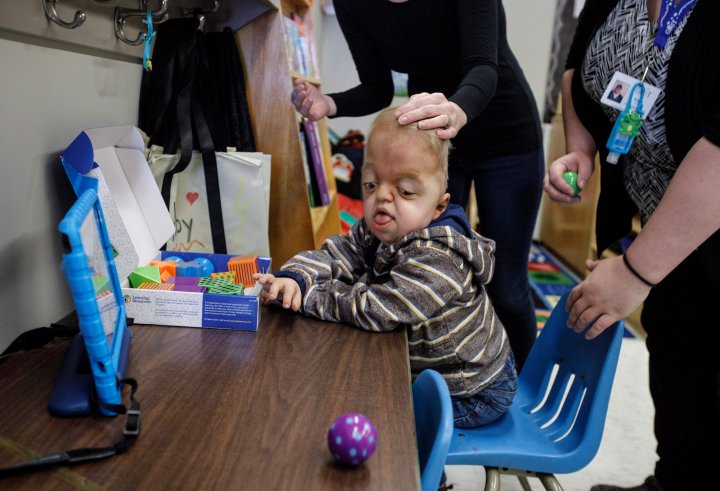 Alberta boy born with rare illness no big deal for classmates: ‘Are we ...