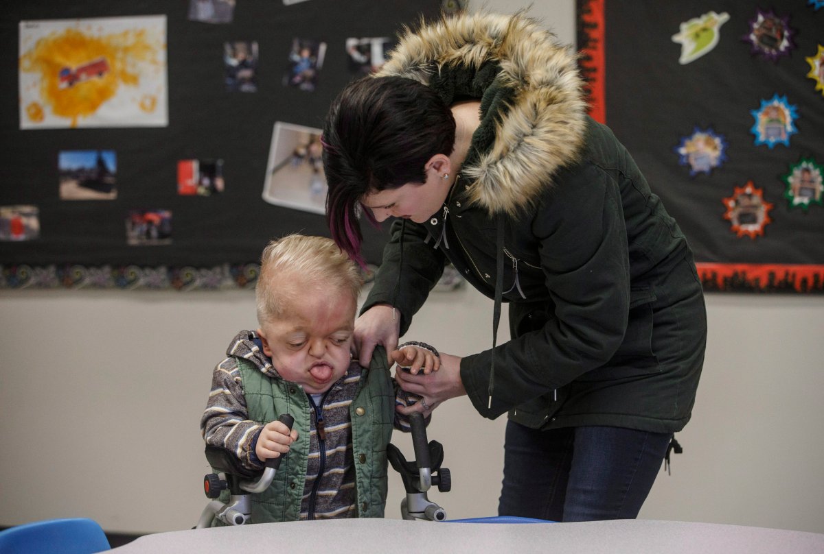 Alberta boy born with rare illness no big deal for classmates: ‘Are we ...