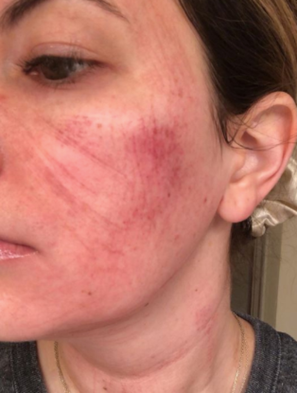 Facial leaves woman’s face ‘on fire,’ a reminder to speak up during ...