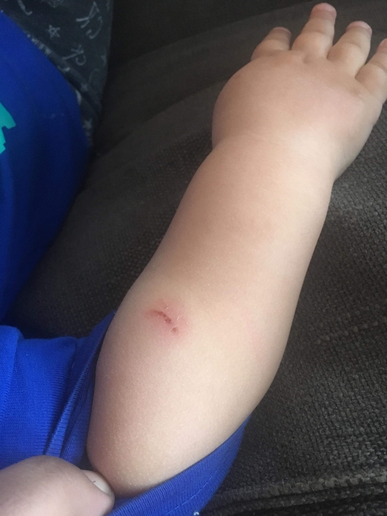Okanagan families demand answers after 70 biting incidents at PIB ...