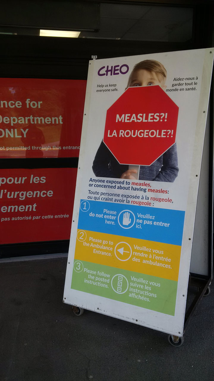 What to do if you think you have measles - National | Globalnews.ca