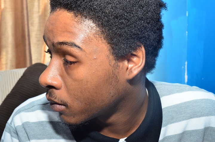 Dafonte Miller testifies he thought he’d go blind after alleged beating ...