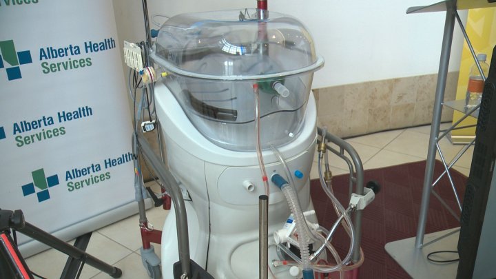 Made-in-Alberta ‘robot body’ that allows lungs to stay alive between ...