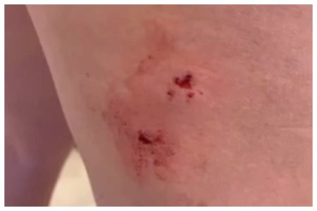 Squirrel gone nuts leaves Texas moms fearful after bloody attacks ...