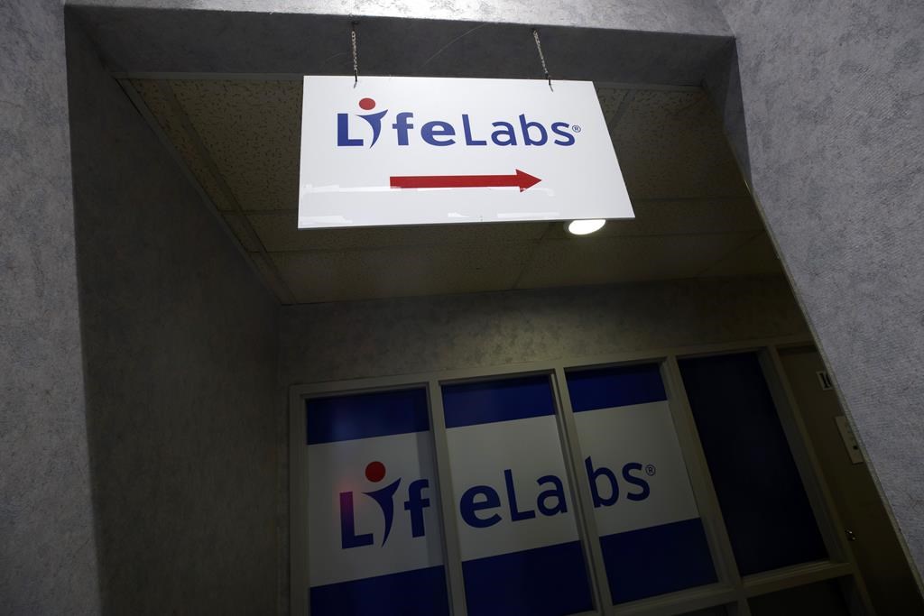 New LifeLabs antibody test announced for British Columbians | Globalnews.ca