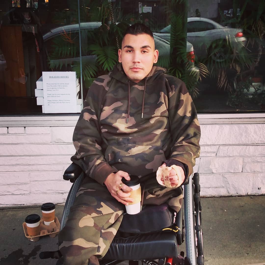 Strathcona Park assault survivor determined to walk again after losing leg - BC | Globalnews.ca