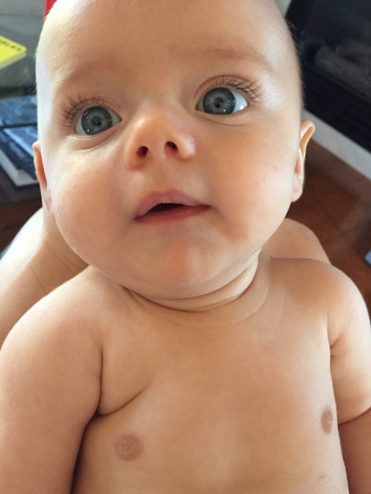 Alberta newborns will be screened for spinal muscular atrophy: ‘Every ...