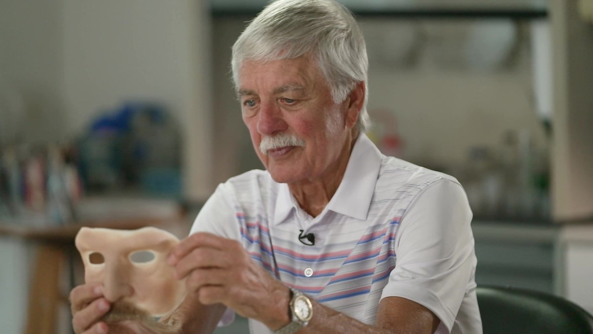 The Spy Who Saved Me: Former CIA master of disguise helps disfigured ...