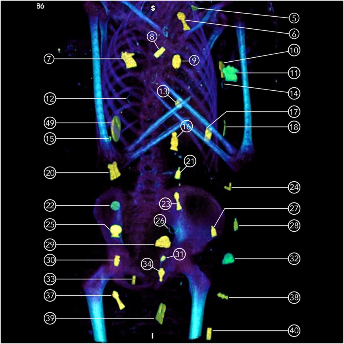 ‘Golden Boy’ mummy digitally unwrapped after 2,300 years, secrets ...
