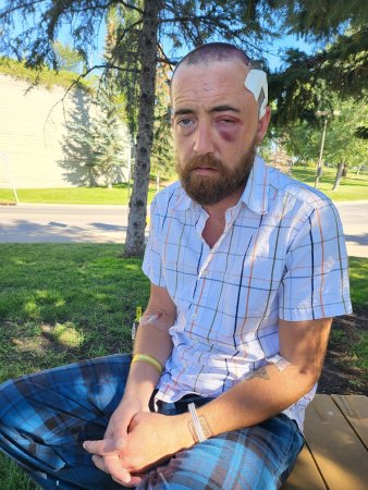 Saskatoon man who’s had 4 brain surgeries to hold fundraiser for ...