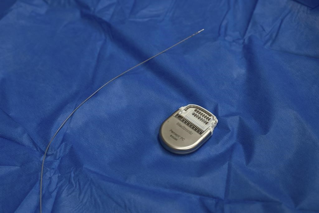 A pacemaker for your brain? It helped one woman with her crippling ...